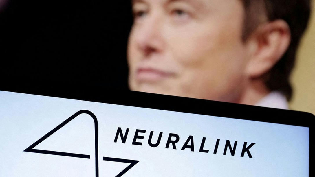 Neuralink pose son premier implant dans un cerveau humain - Quantstreams